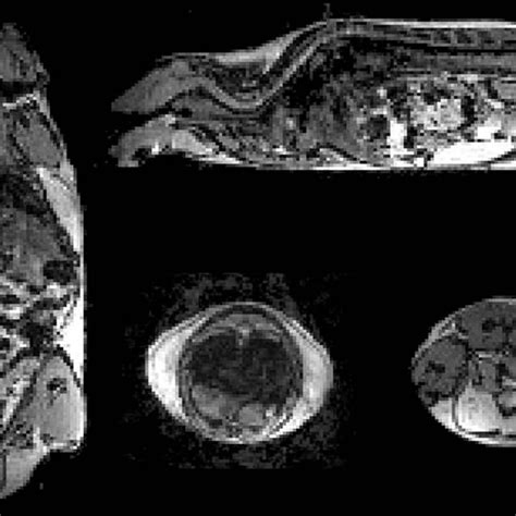 multiplanar reconstructions of 3d gre acquisition of a mouse with