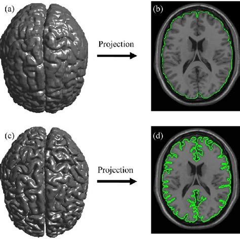 cerebral cortex surface obtained after 3d segmentation of volumetric