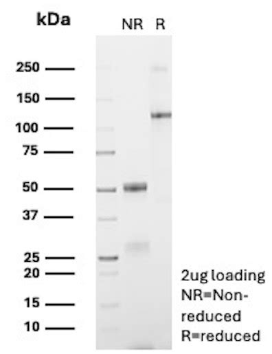 Recombinant Cd3e T Cell Marker Antibody Clone C3e 4653r Gene Id 916