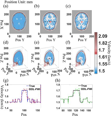 Figure 10 From Transcranial Ultrasound Imaging With Decomposition