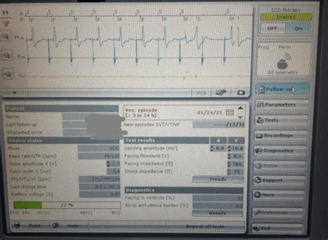 Icd Interrogation Report Revealing Multiple Episodes Of Ventricular Download Scientific Diagram