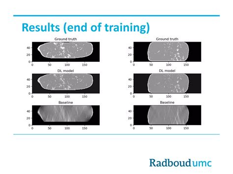 Inverse Problems In Medical Imaging Pptx