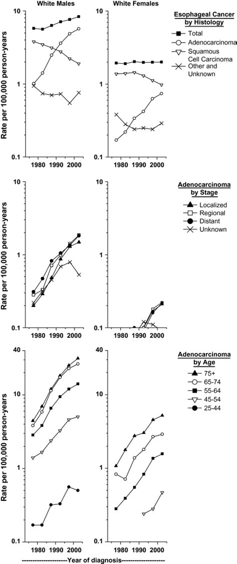 Incidence Of Adenocarcinoma Of The Esophagus Among White Americans By
