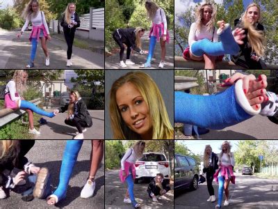 Cassidy LLC What To Do With A Broken Cast Shoe With Hopping In HD X Broken Angelz Foot