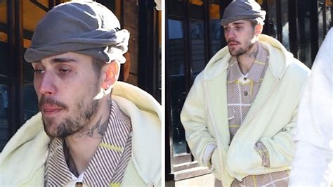 Fans Fear For Justin Bieber In New Photos Very Concerning News Com Au Australias Leading