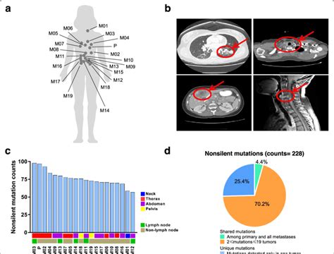 Synchronous Metastatic Tumors Exhibit Heterogeneous Growth And Somatic Download Scientific