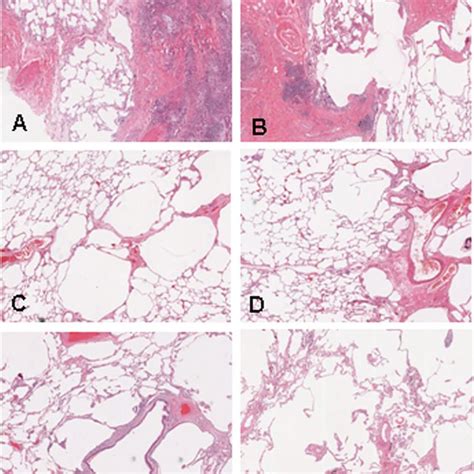 correlation between lung function parameters and histopathology and