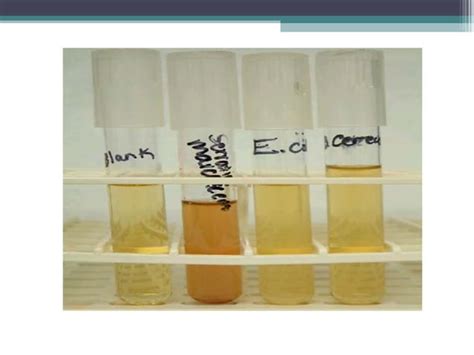 Bacterial Count Ppt Lllllllllllllllllllll Ppt