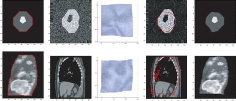 Figure 1 From A Variational Joint Segmentation And Registration Framework For Multimodal Images