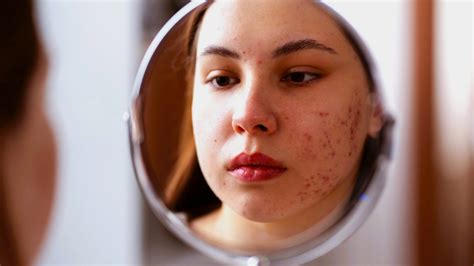 Skin Diseases Prevention And Early Detection Buzztify