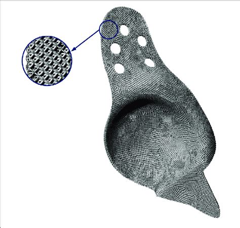 Final Cad Model Of The Functionally Graded Lattice Bs Cage And Its Download Scientific