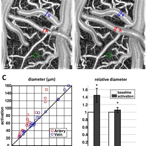 Oct Angiography Scanning Protocols A Three Dimensional Scanning