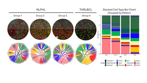Spatial Proteomics Offer Novel Insights Into Rare Lymphomas With Sparse Tumor B Cells Research