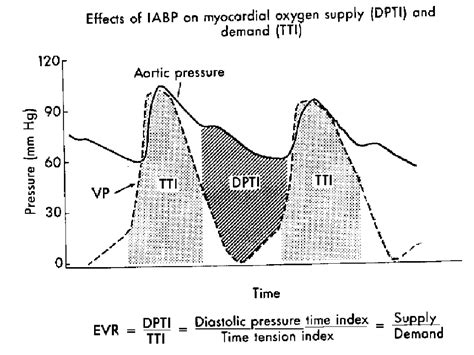 Iabp Principle Hemodynamic Timing Weaning 2016 Background Asmiha Isman Edit Pptx