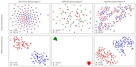 Electroencephalography Based Motor Imagery Classification Using Multi Scale Feature Fusion And