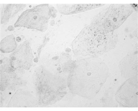 Break The Mystery Of Female Orgasm The Liquid From My Ejaculation Is Examined Under A Microscope