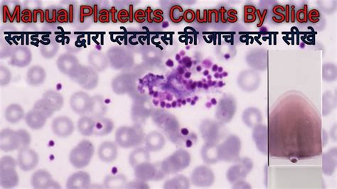 Platelets Slide