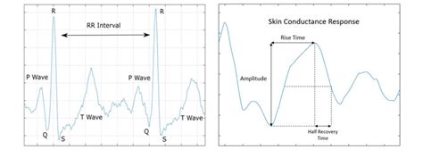 A Example Of The Interval Between R Peaks Rr Interval From Ecg