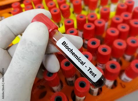 Salmonella Detection Method By Using Triple Sugar Iron Tsi Agar In