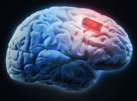 Australian Researchers Have Developed A Tiny Brain Stimulator That Could Treat Epilepsy