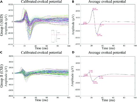Ecog Recorded Electrical Stimulation Electrical Stimulation Was Download Scientific Diagram