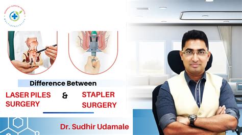 Stapler Hemorrhoidopexy Vs Laser Hemorrhoidoplasty Best Laser Piles