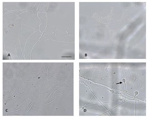 Asexual Structures Of Fusarium Sp Isolated On Pda 40x A Mycelium