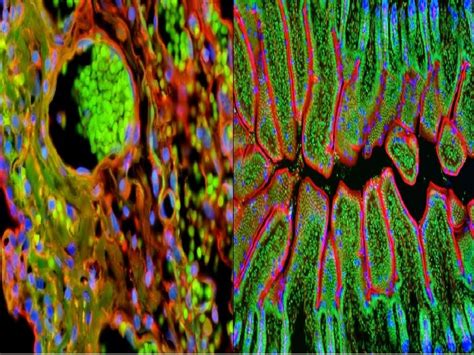 What Is The Microscope The Microscope Magnifies The