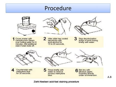 Acid Fast Staining Pdf