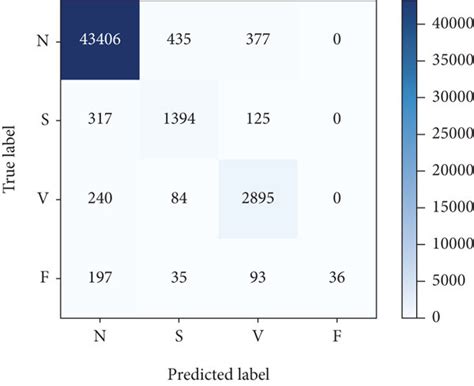 Confusion Matrix Without Data Augmentation Download Scientific Diagram