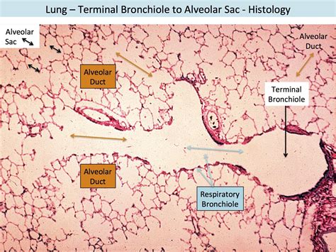 Lung Microscope Slide Labeled At Penny Troche Blog
