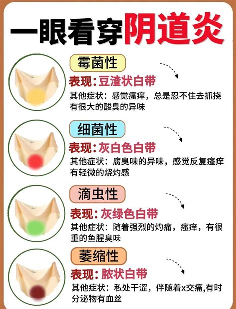 阴道炎的四种类型及护理方法，你知道吗？