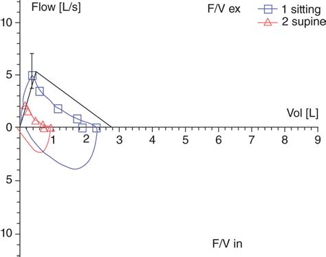 Positional Spirometry Sitting Flow Volume Loop Shown In Blue 1 And