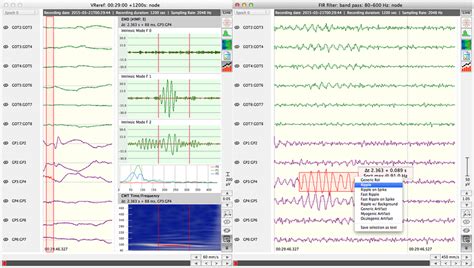 Compacted View Of Synchronized Waveform Display Left Window Standard Download Scientific