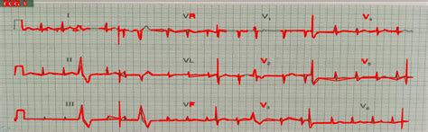 Extract Graph Data From Image Python Opencv
