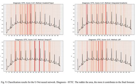 Dsp Explainable Artificial Intelligence Techniques In Medical Signal
