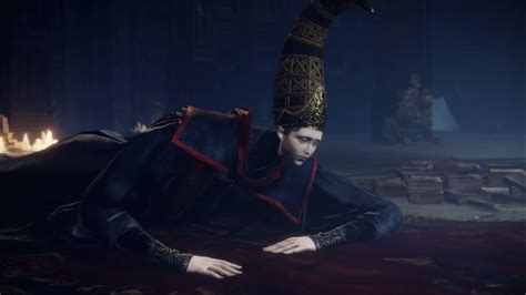 Renalla Na Unha Youtube