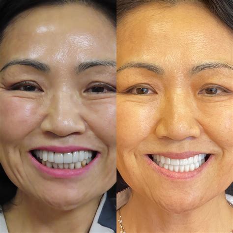 David W Epstein Dds Inc Cosmetic Implant And Reconstructive Dentistry Updated David W