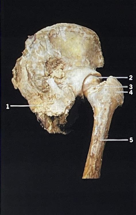 Hip Joint Posterior View Diagram Quizlet