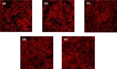 microstructure of dough produced with different particle size wheat