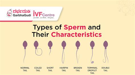 Sperm Photos Opinion | What Are Sperm Telling Us? The New York Times