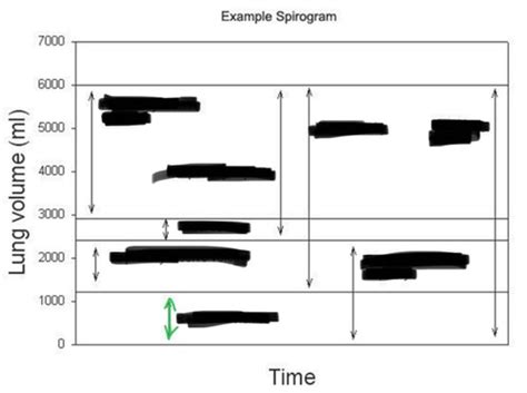 Lab 15 Spirogram Flashcards Quizlet