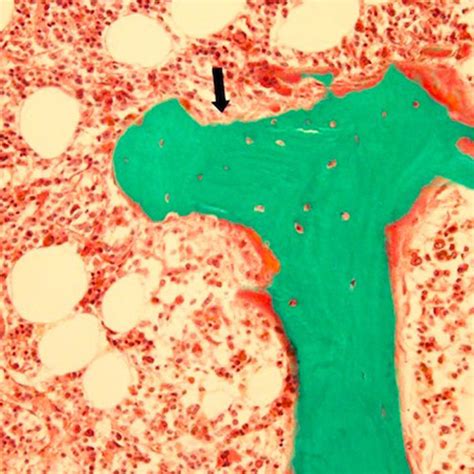 Risk Factors For Adynamic Bone Disease Download Scientific Diagram