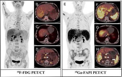 Clinical Nuclear Medicine