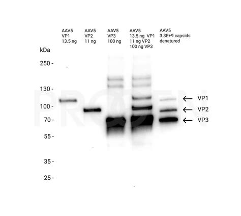 AAV5 VP1, recombinant protein | 640833