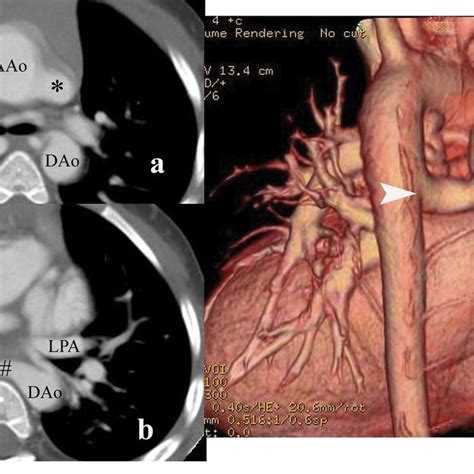 The Diagnostic Algorithm Used For Patients With Pa Vsd Download The Diagnostic Algorithm Used For Patients With Pa Vsd Download