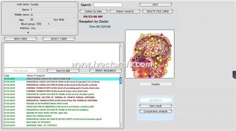 Metatron Metapathia Nls Systeme Vector Nls Nls Vector Vector Nls Scan Vector Nls Device 9d Nls