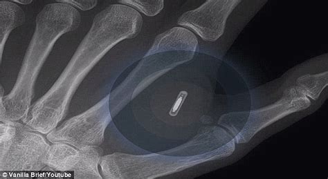 Swedish Company Implants Microchips In Its Staff Daily Mail Online
