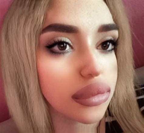 Bimbo Lips 1 By Roundabout16 On Deviantart