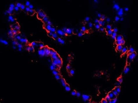 How Gurdon Institutes Dr Emma Rawlins Uses Organoids To Unravel